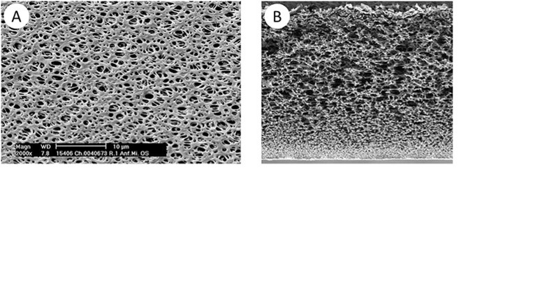 Heutige Anforderungen an die Sterilfiltration und deren Integritätstestung